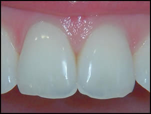 upt odontología: LAS ENCIAS